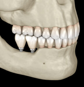 Universal Dentistry | Dentist | Philadelphia, PA